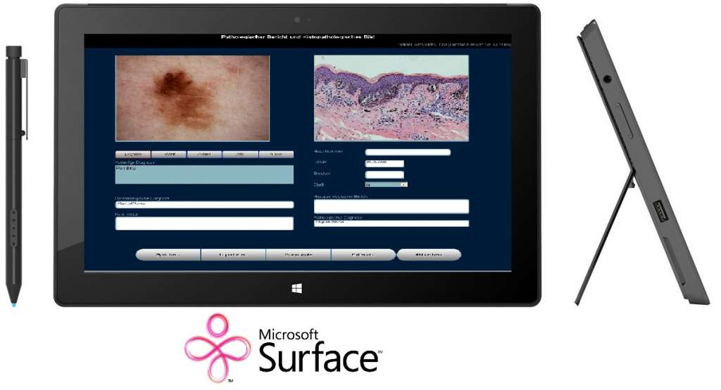 Derma / MoleMax HD – Leofarma Sağlık Ürünleri